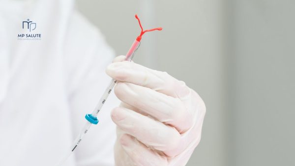 Spirale al rame (lo iud al rame): una scelta consapevole per la tua ...